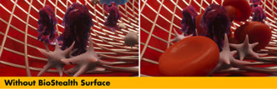 Surpass Elite Flow Diverter | Stryker